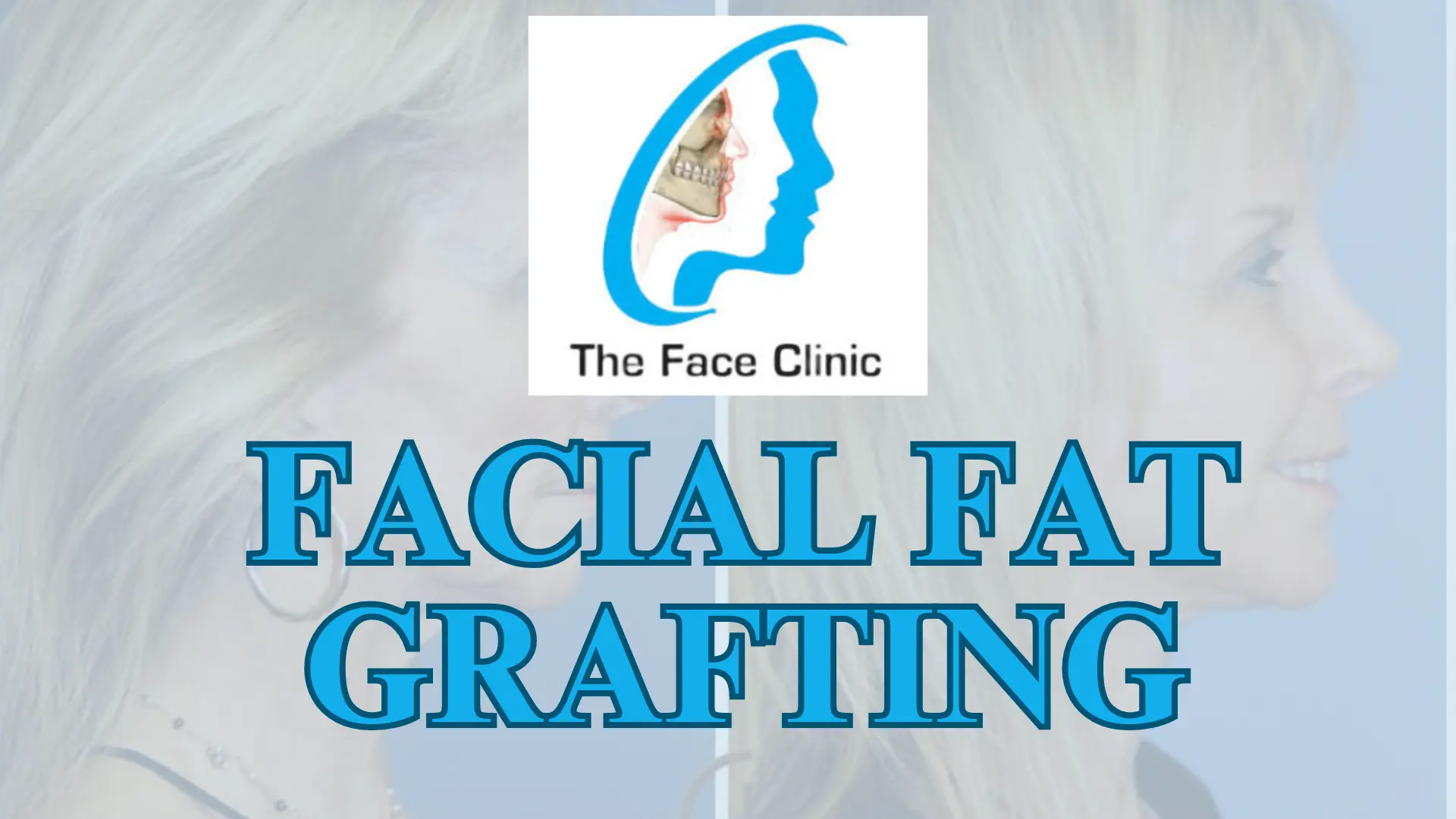 Facial Fat Grafting: Rejuvenate Your Look Naturally - The Face Clinic ...